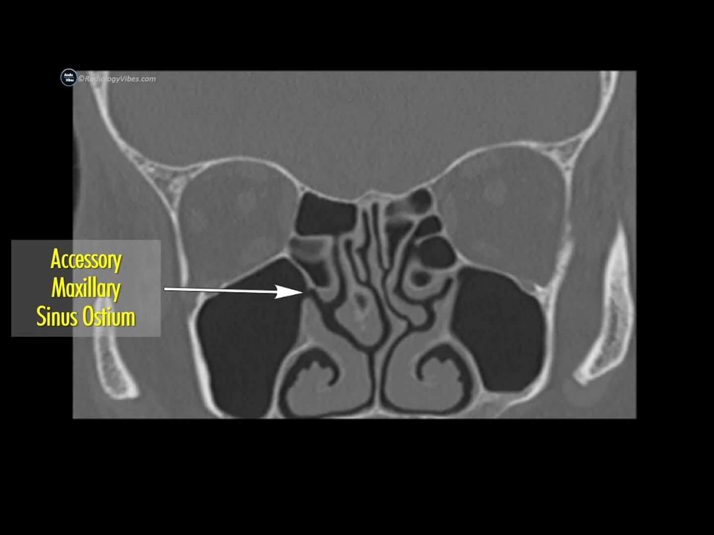 Radiology Vibes | Online Learning Platform For Radiologists.