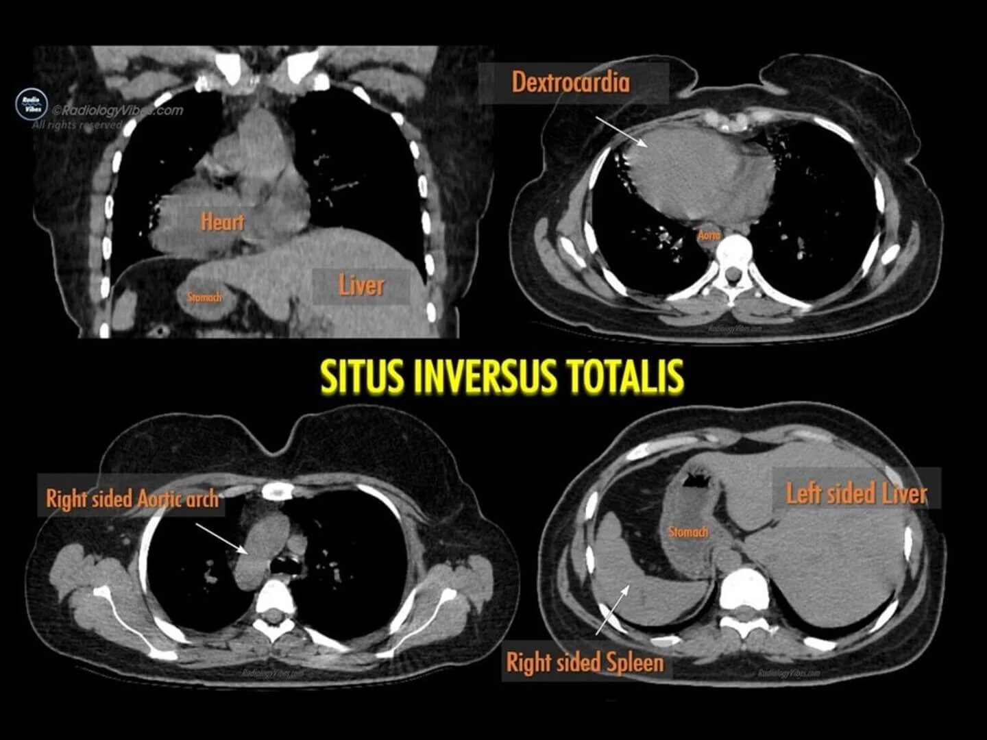 Radiology Vibes | Online Learning Platform For Radiologists.