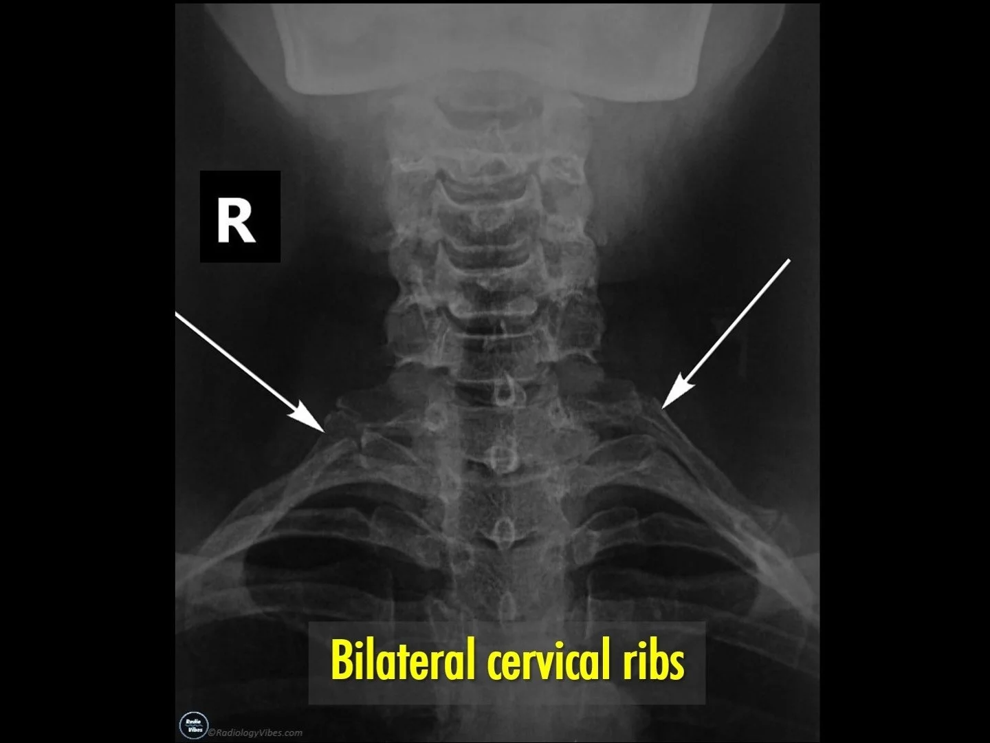 Radiology Vibes | Online Learning Platform For Radiologists.