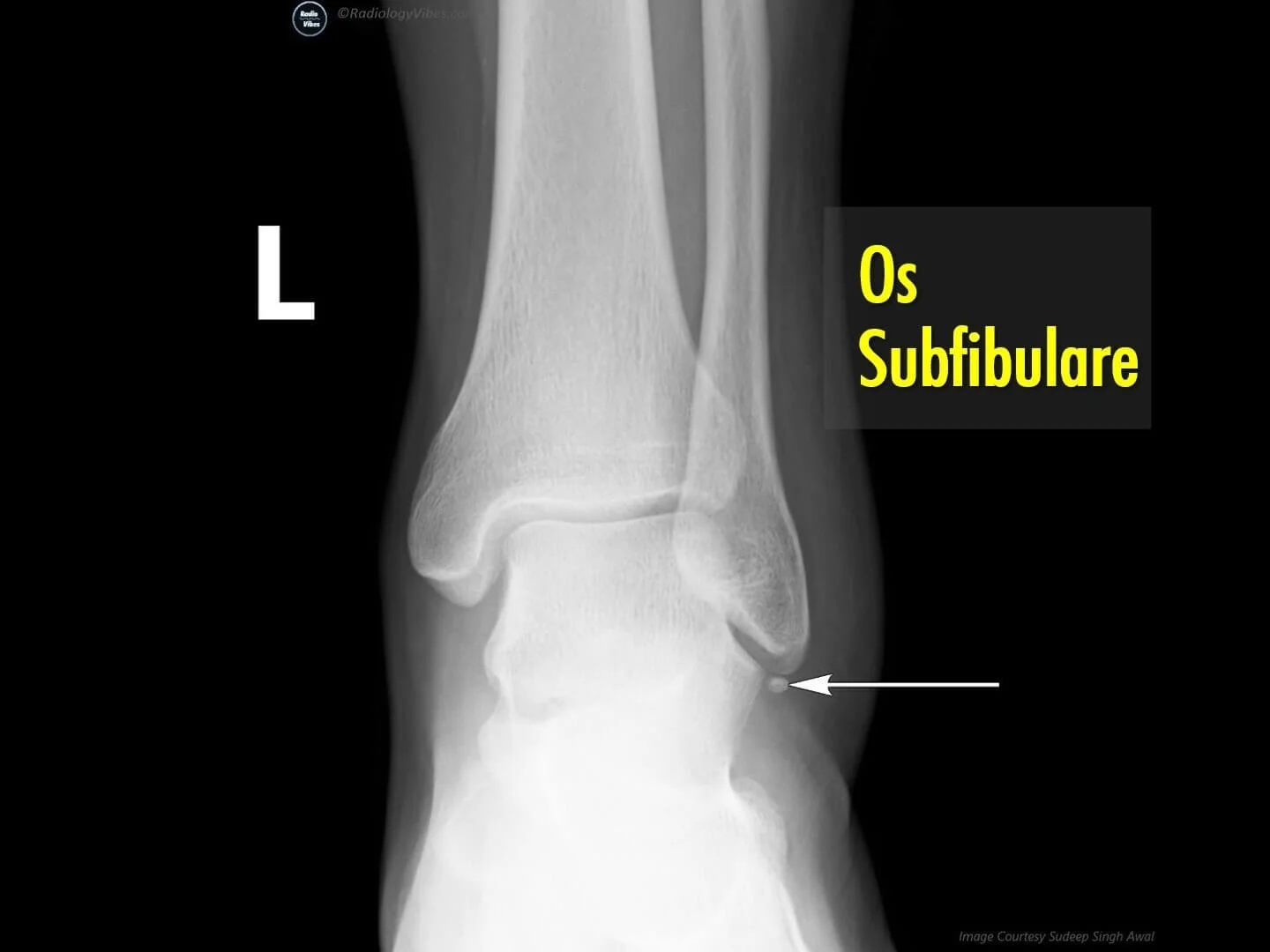 Radiology Vibes | Online Learning Platform For Radiologists.