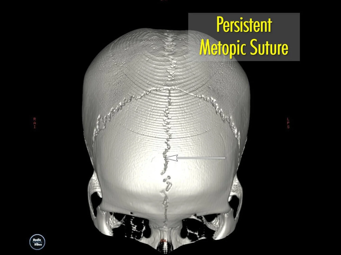 Radiology Vibes | Online Learning Platform For Radiologists.