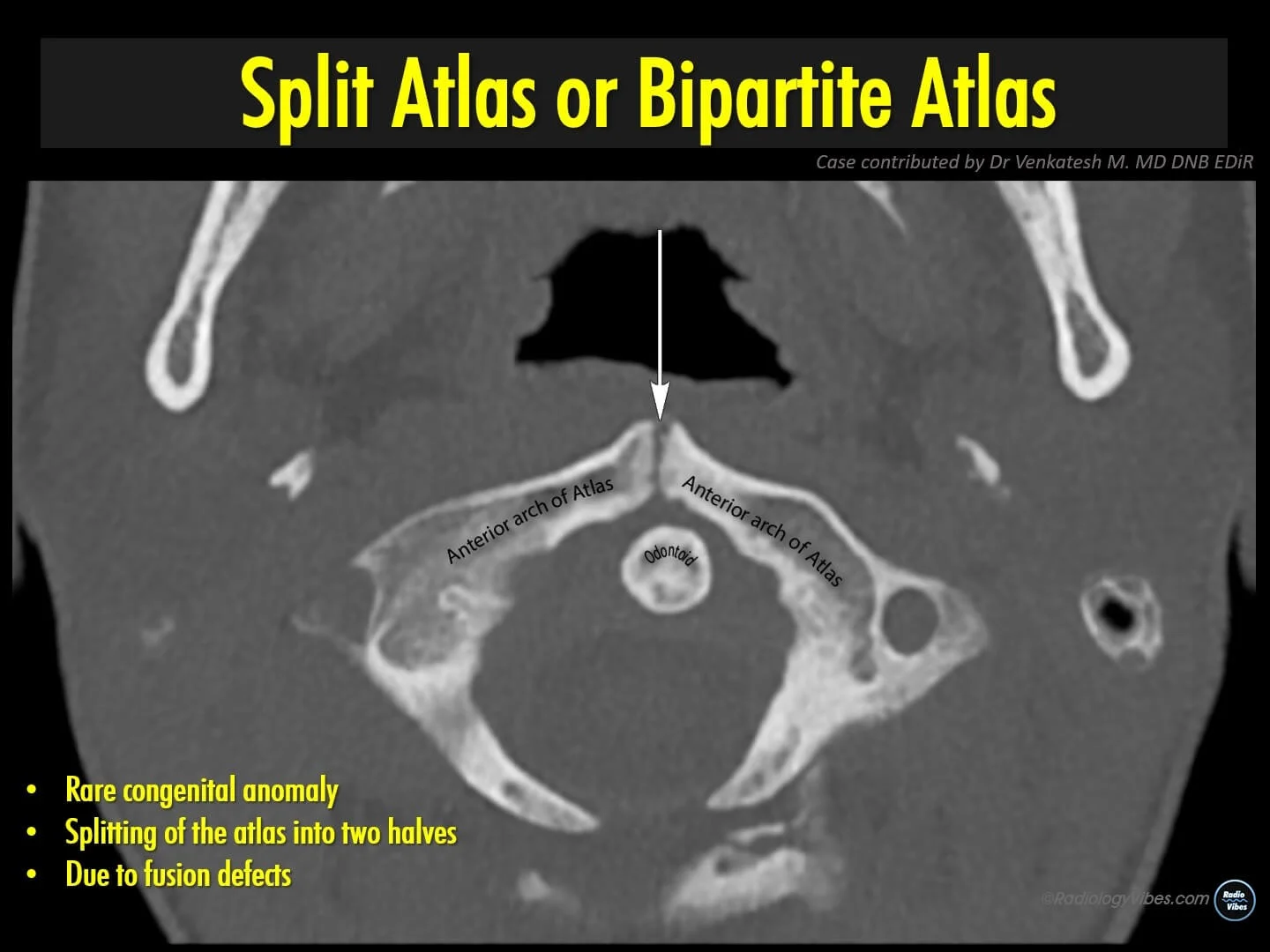 Radiology Vibes | Online Learning Platform For Radiologists.