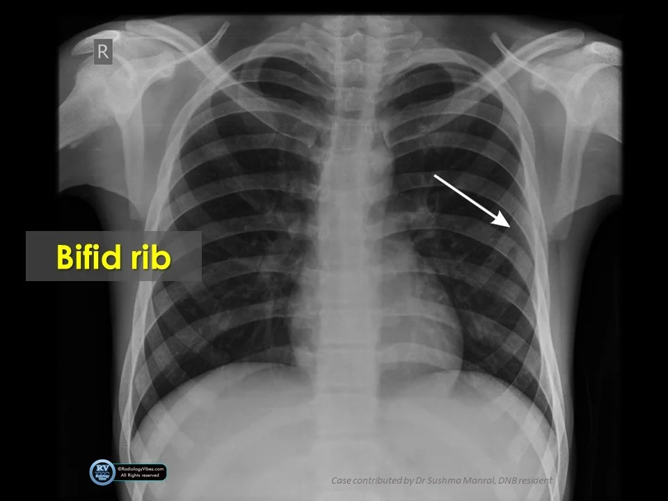 Radiology Vibes | Online Learning Platform For Radiologists.
