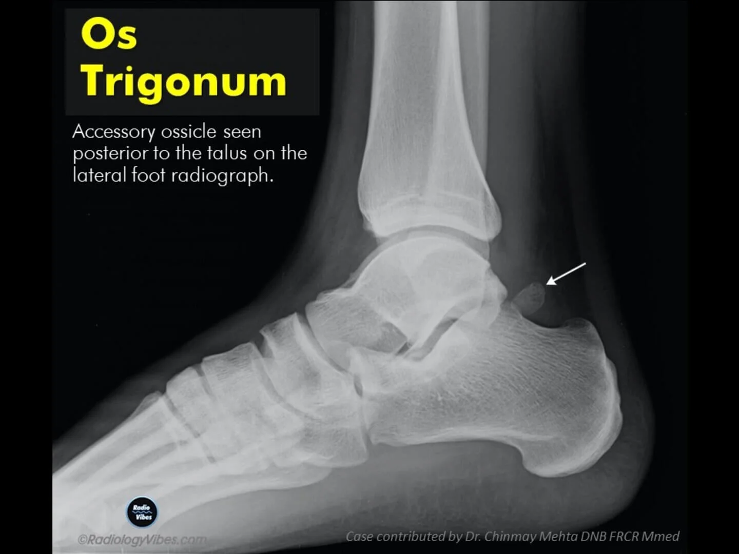 Radiology Vibes | Online Learning Platform For Radiologists.