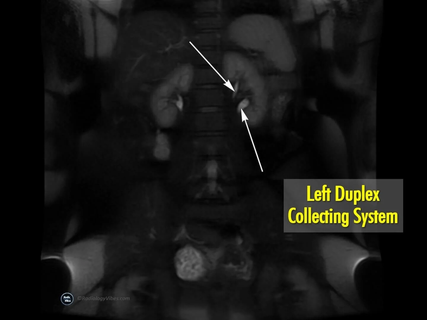Radiology Vibes | Online Learning Platform For Radiologists.