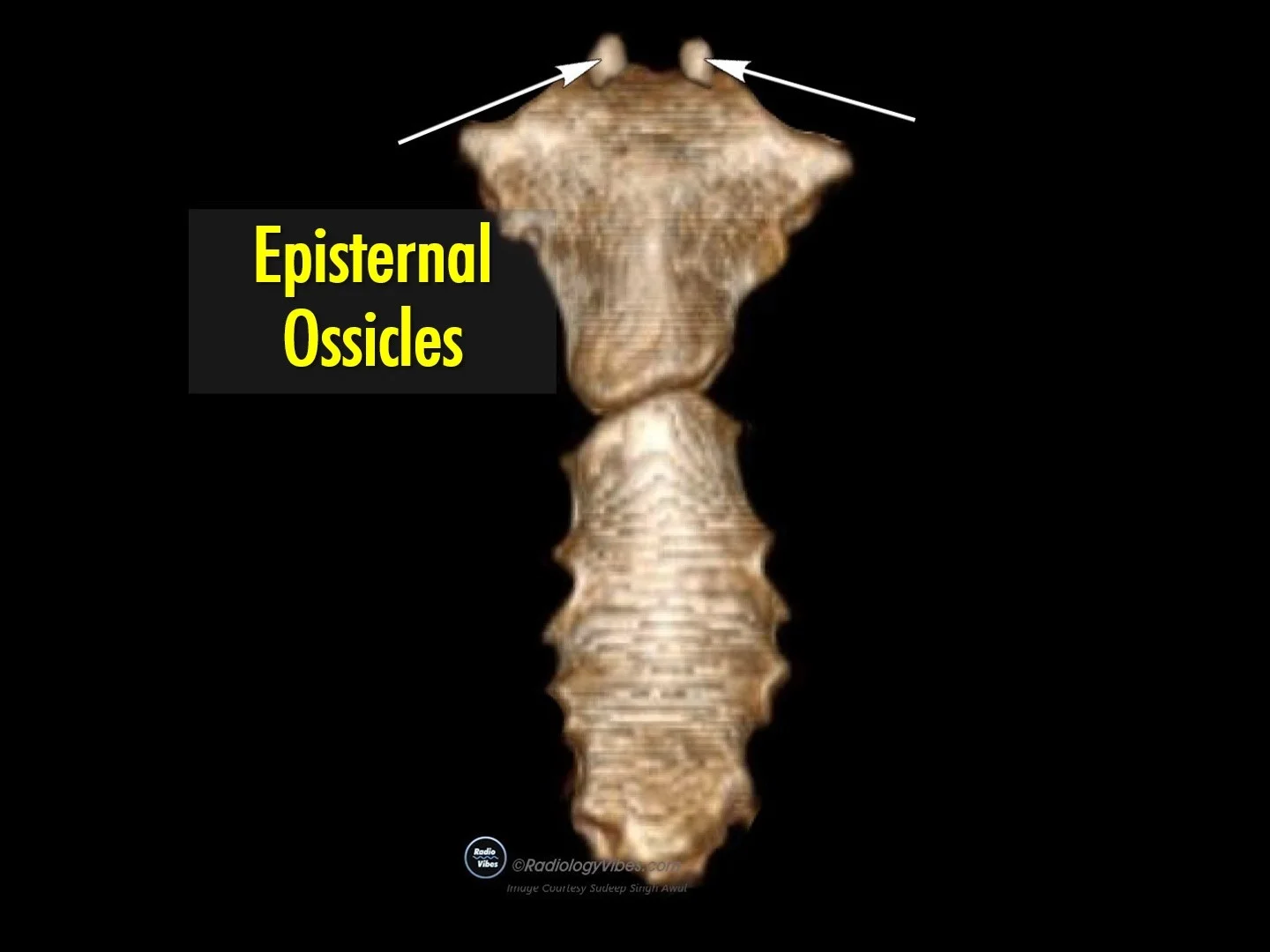 Radiology Vibes | Online Learning Platform For Radiologists.