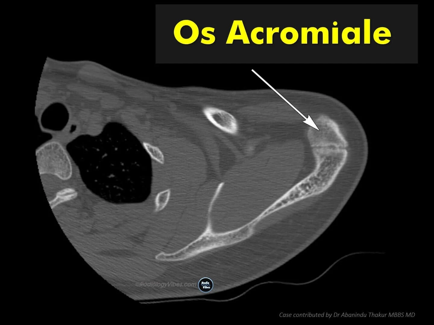 Radiology Vibes | Online Learning Platform For Radiologists.
