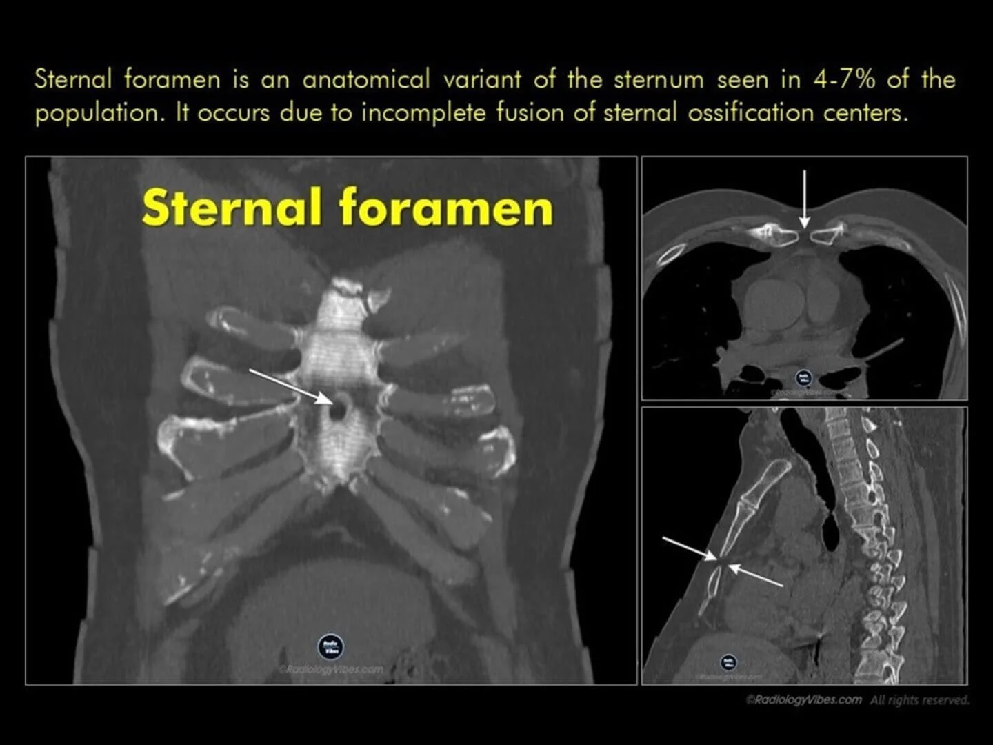 Radiology Vibes | Online Learning Platform For Radiologists.