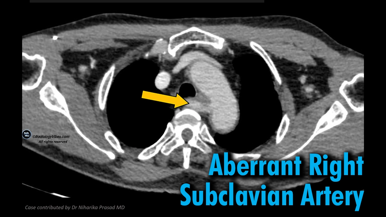 Radiology Vibes | Online Learning Platform For Radiologists.