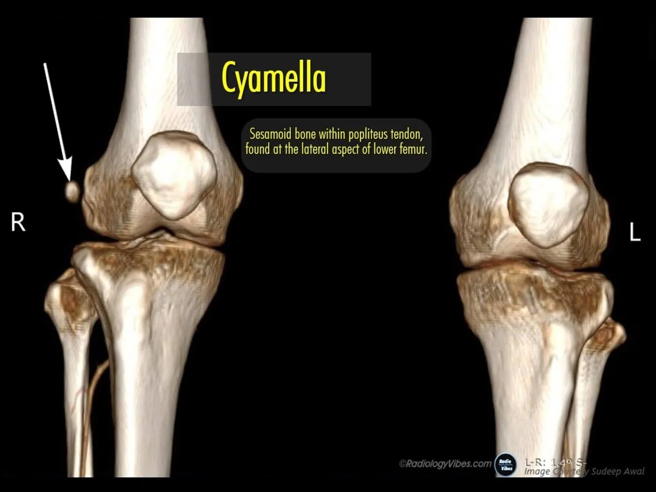 Radiology Vibes | Online Learning Platform For Radiologists.