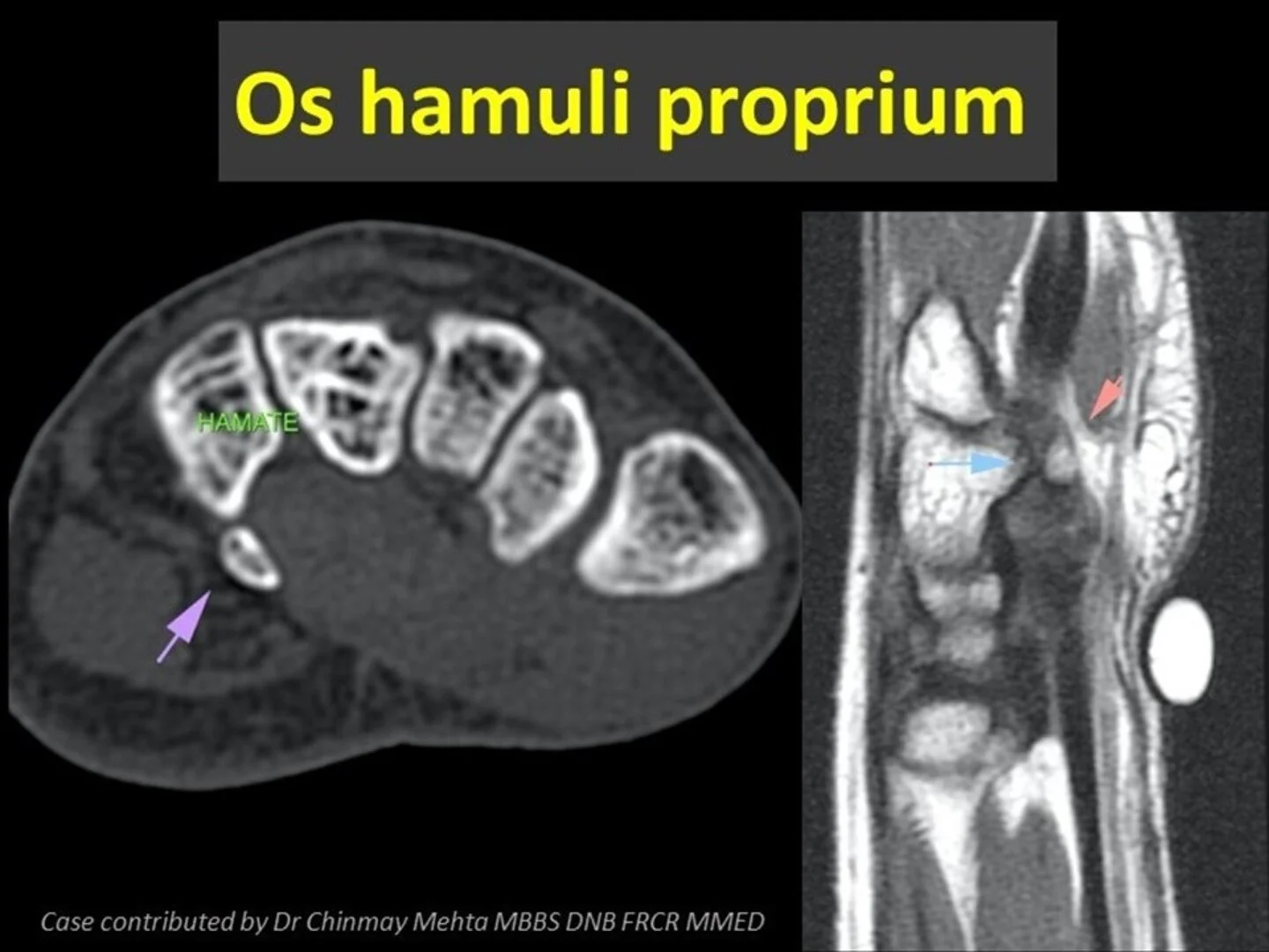Radiology Vibes | Online Learning Platform For Radiologists.