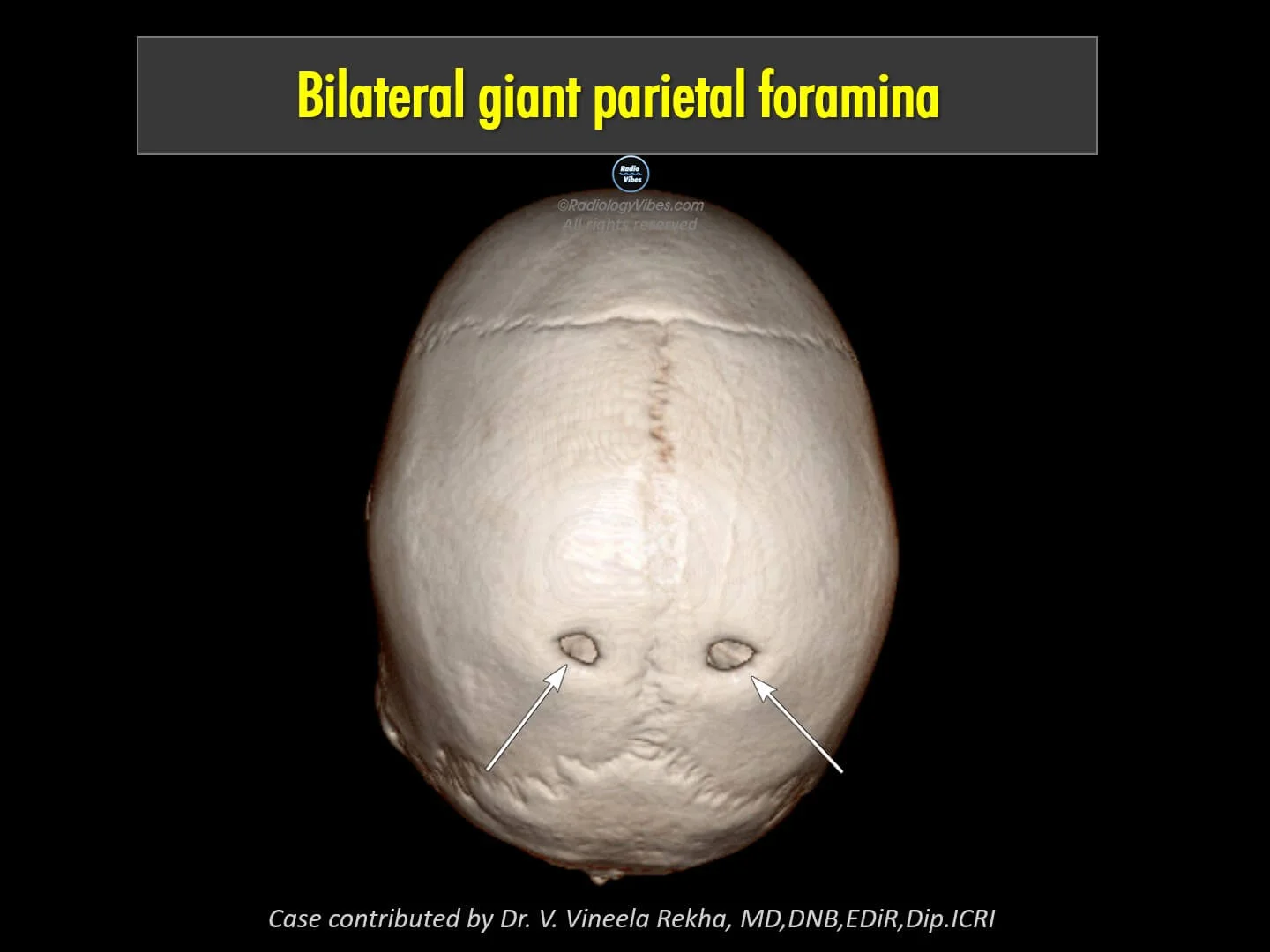 Radiology Vibes | Online Learning Platform For Radiologists.