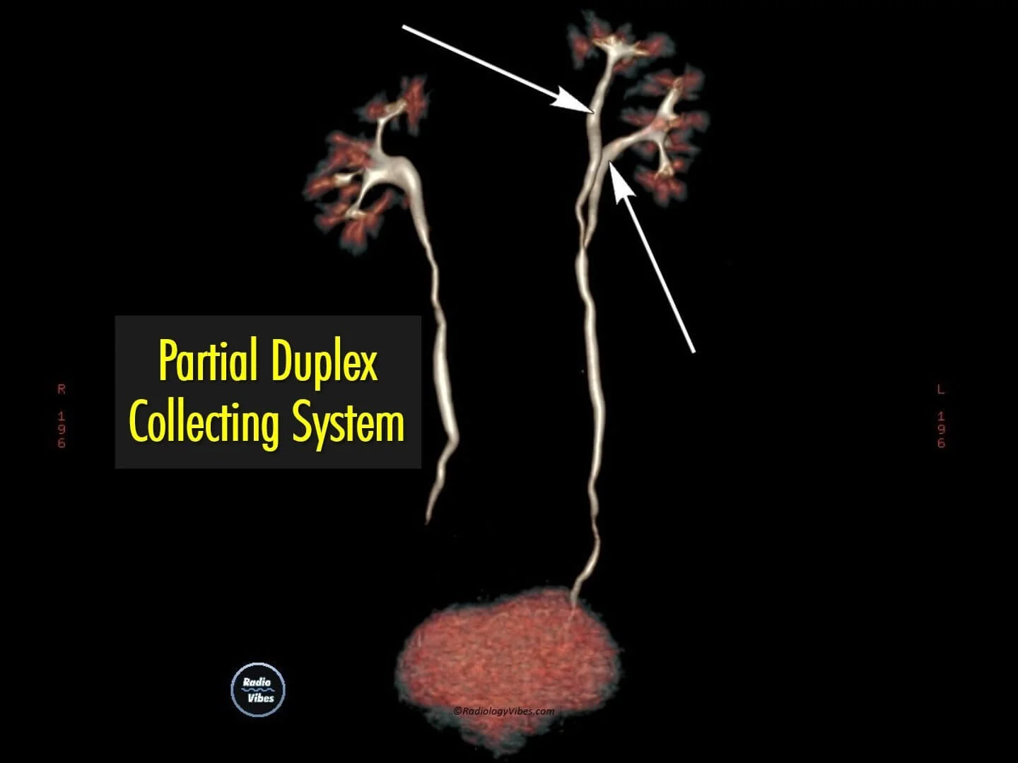 Radiology Vibes | Online Learning Platform For Radiologists.