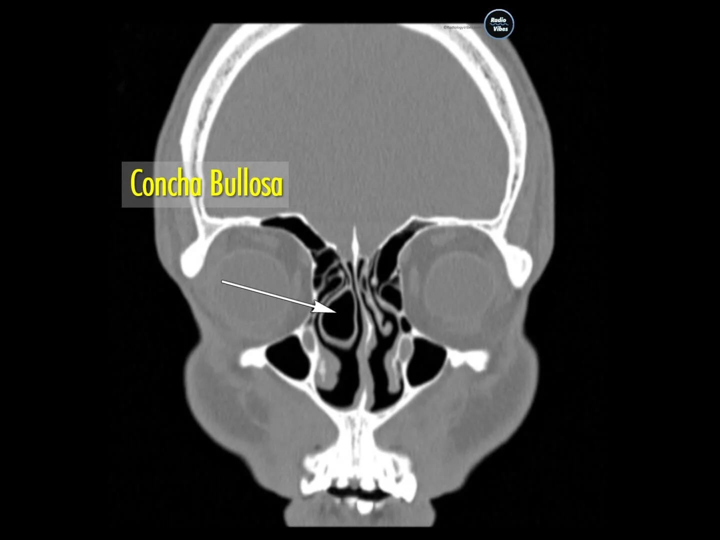 Radiology Vibes | Online Learning Platform For Radiologists.