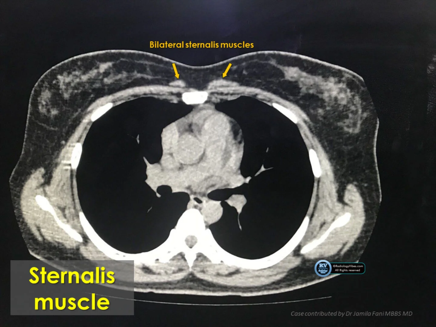 Radiology Vibes | Online Learning Platform For Radiologists.