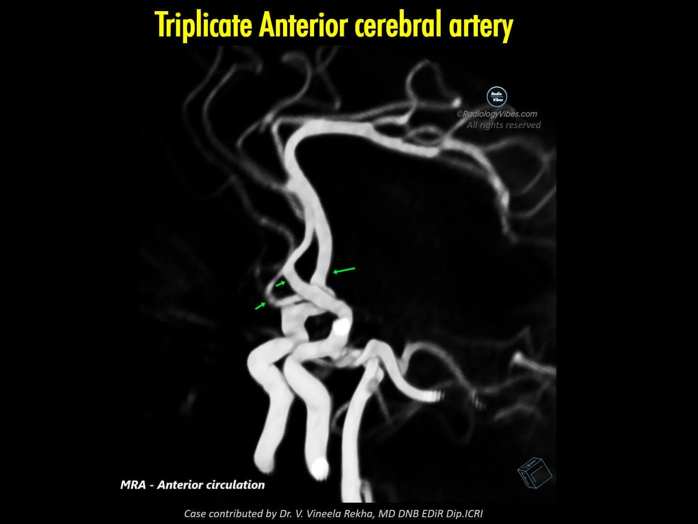 Radiology Vibes | Online Learning Platform For Radiologists.