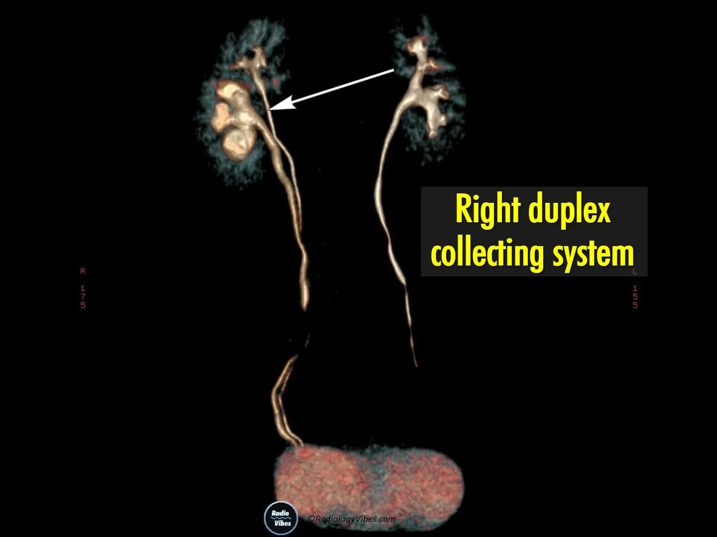Radiology Vibes | Online Learning Platform For Radiologists.