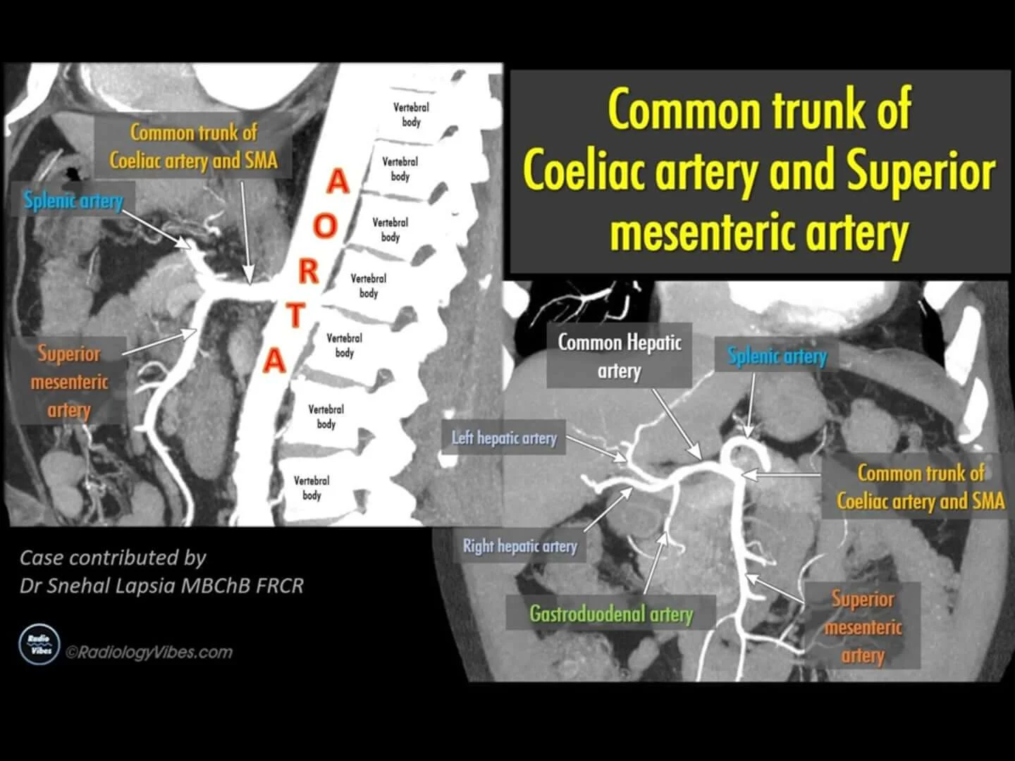 Radiology Vibes | Online Learning Platform For Radiologists.