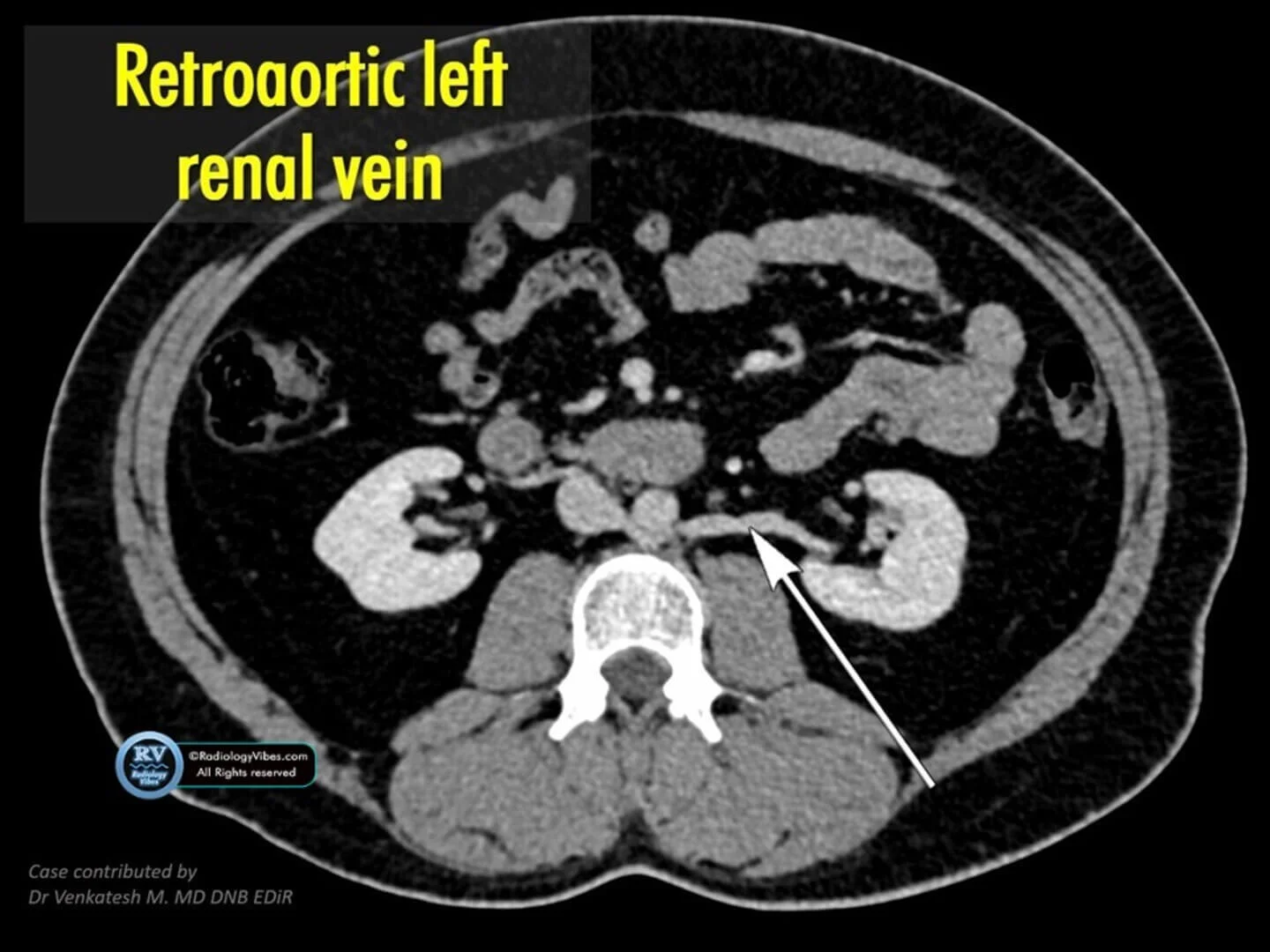 Radiology Vibes | Online Learning Platform For Radiologists.