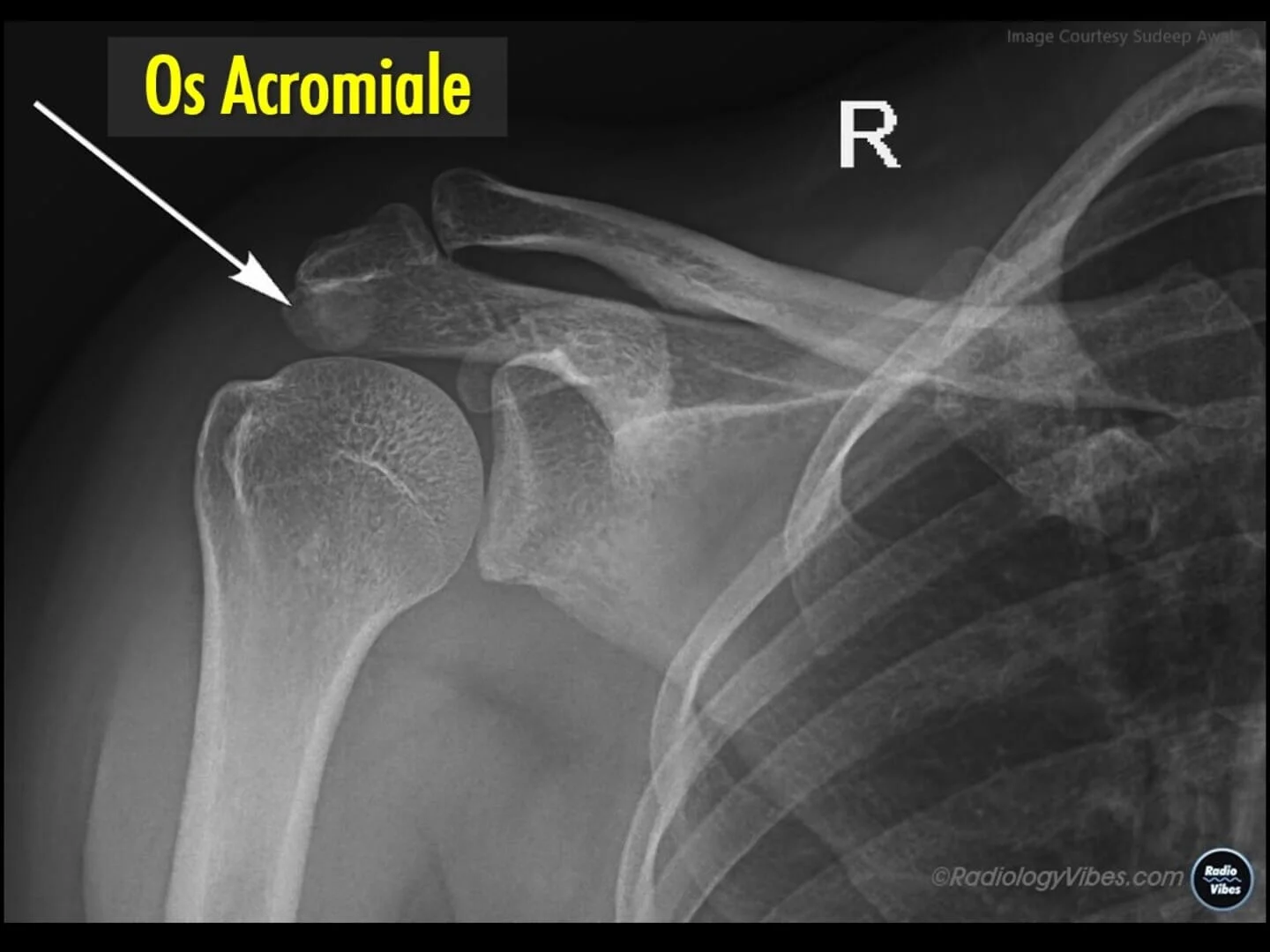 Radiology Vibes | Online Learning Platform For Radiologists.