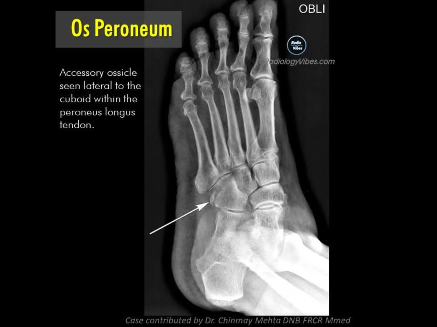 Radiology Vibes | Online Learning Platform For Radiologists.