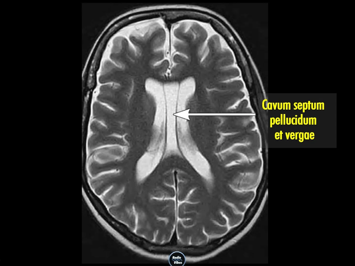 Radiology Vibes | Online Learning Platform For Radiologists.