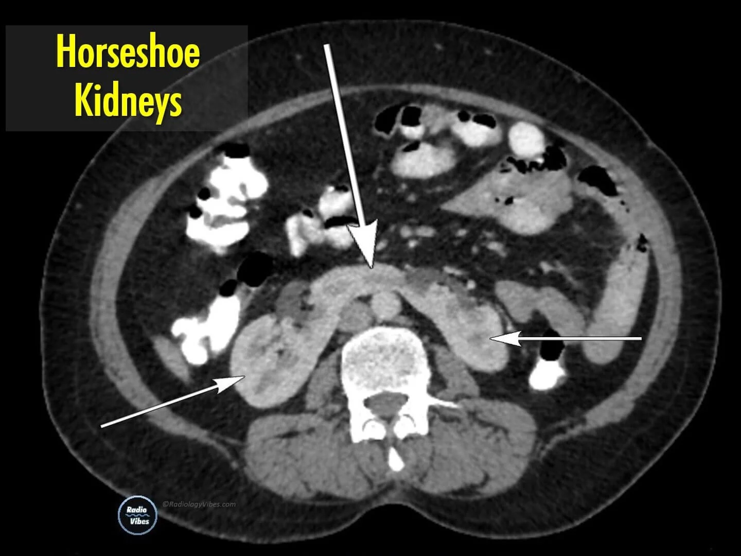 Radiology Vibes | Online Learning Platform For Radiologists.