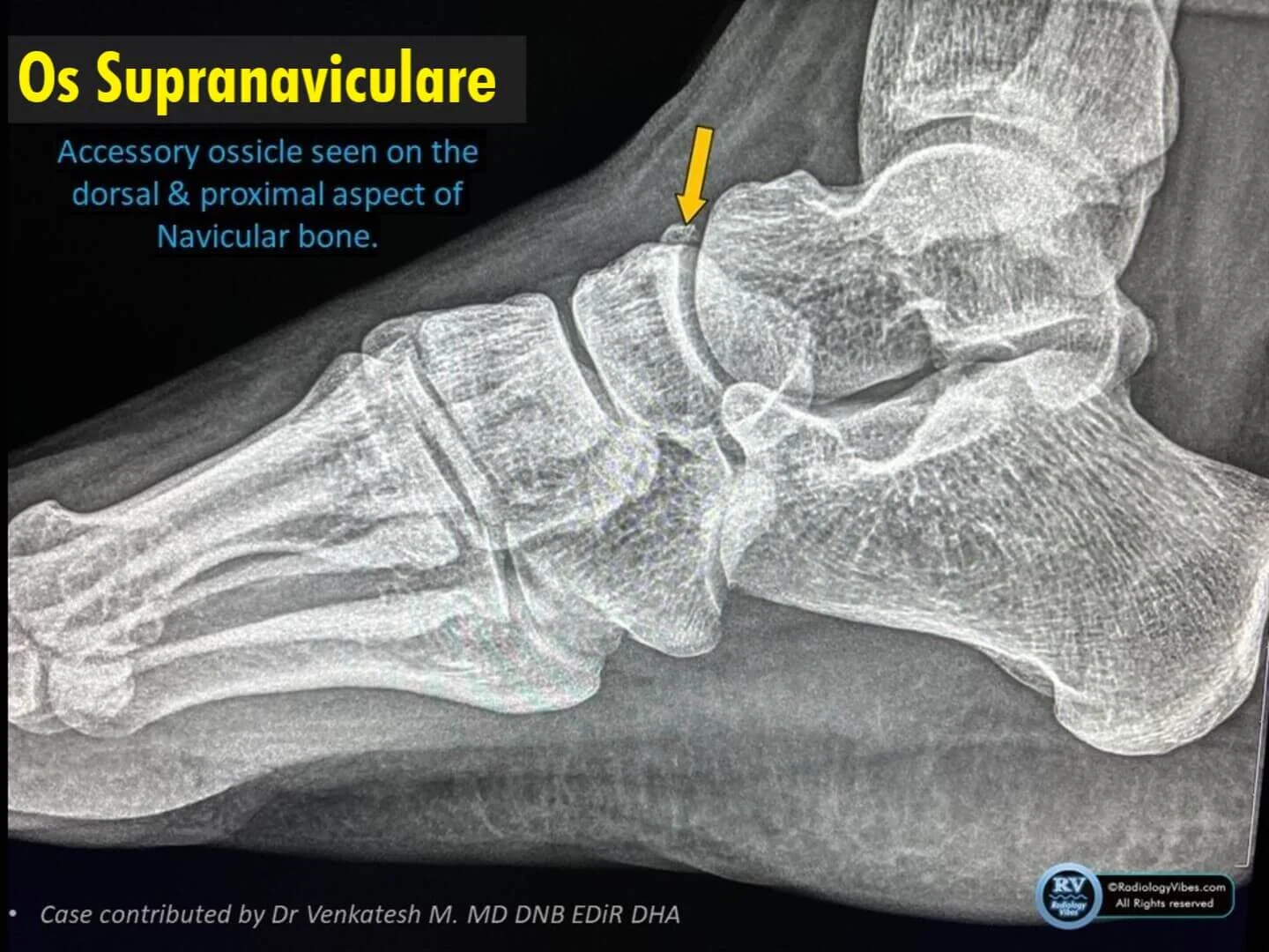 Radiology Vibes | Online Learning Platform For Radiologists.