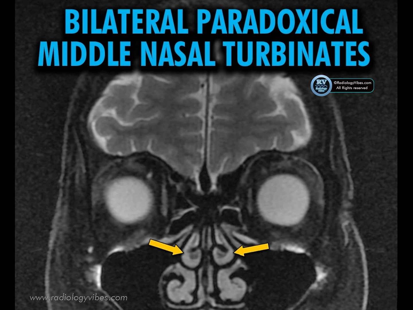 Radiology Vibes | Online Learning Platform For Radiologists.