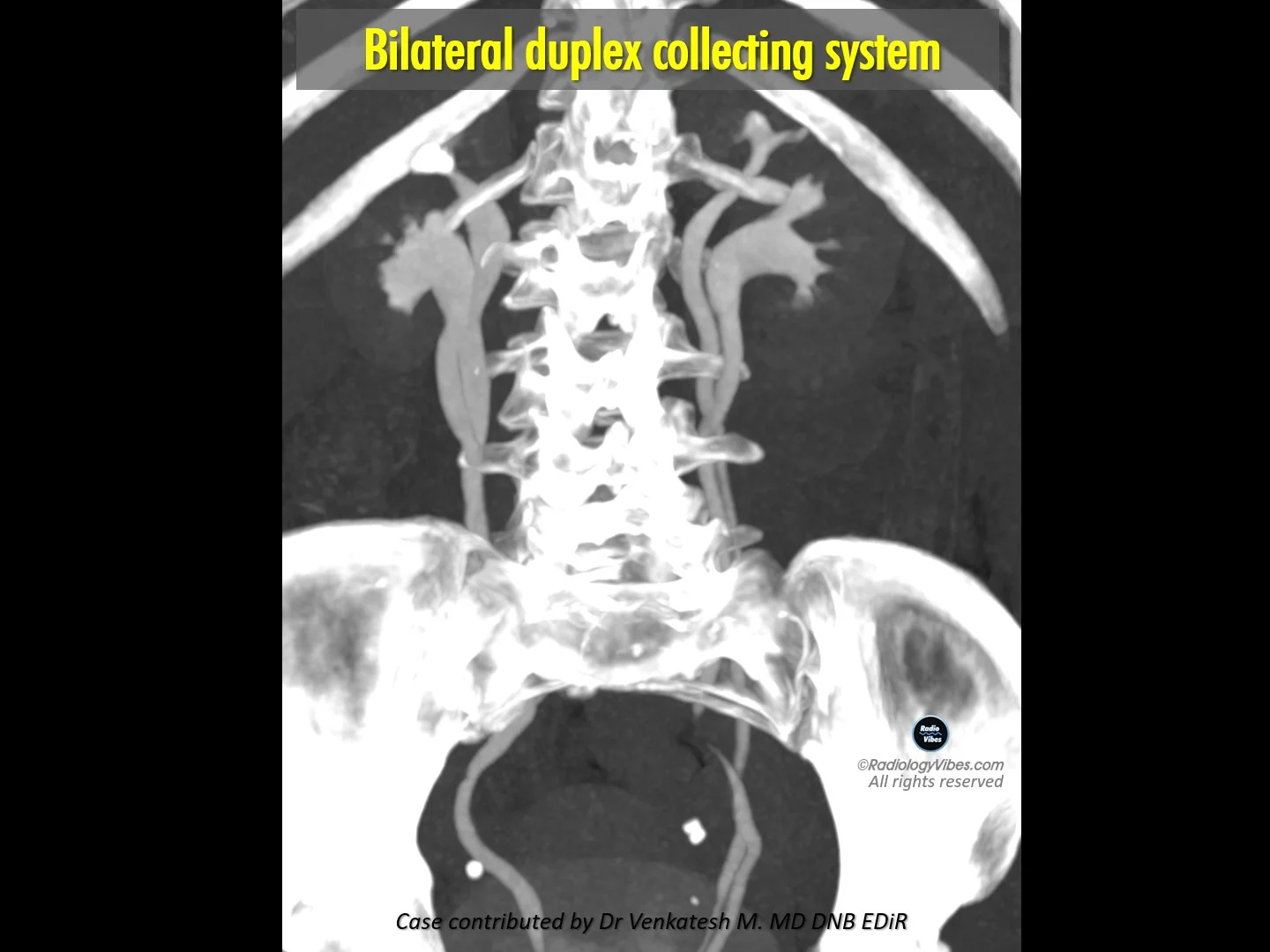 Radiology Vibes | Online Learning Platform For Radiologists.