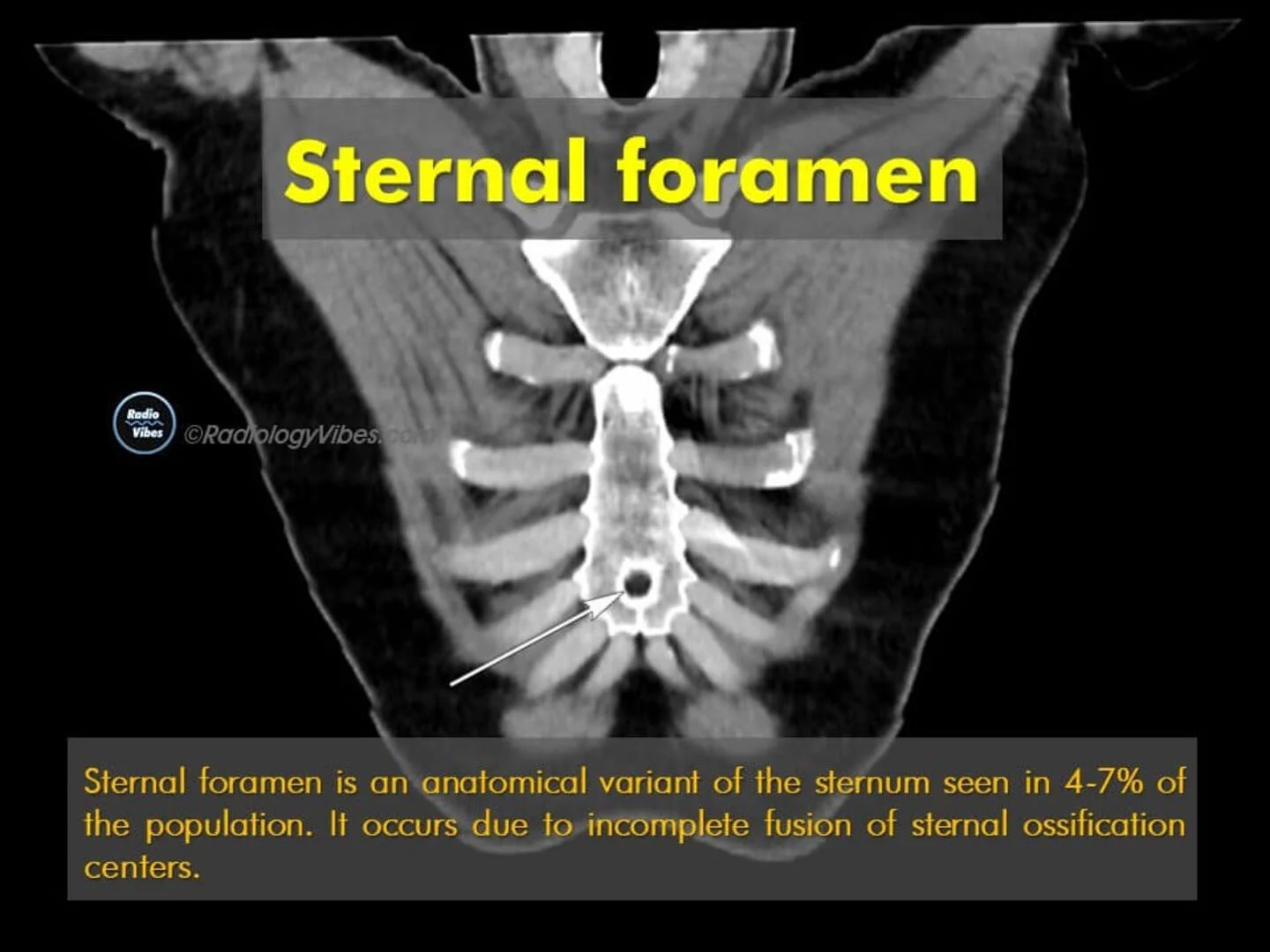 Radiology Vibes | Online Learning Platform For Radiologists.