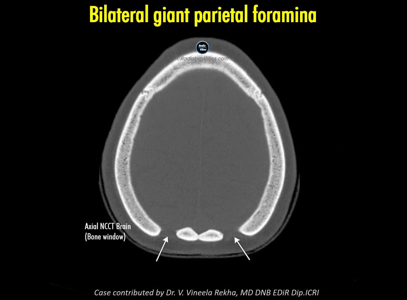 Radiology Vibes | Online Learning Platform For Radiologists.