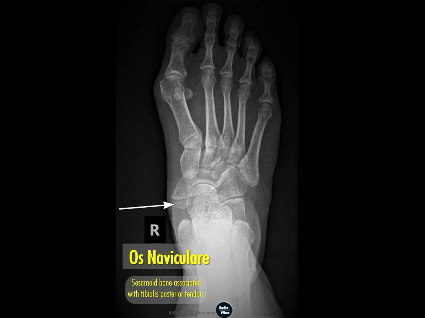 Radiology Vibes | Online Learning Platform For Radiologists.