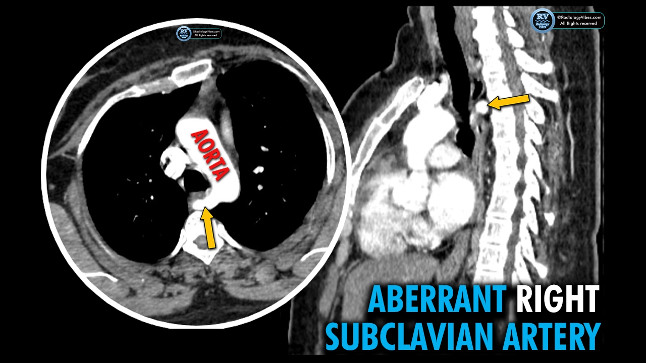 Radiology Vibes | Online Learning Platform For Radiologists.