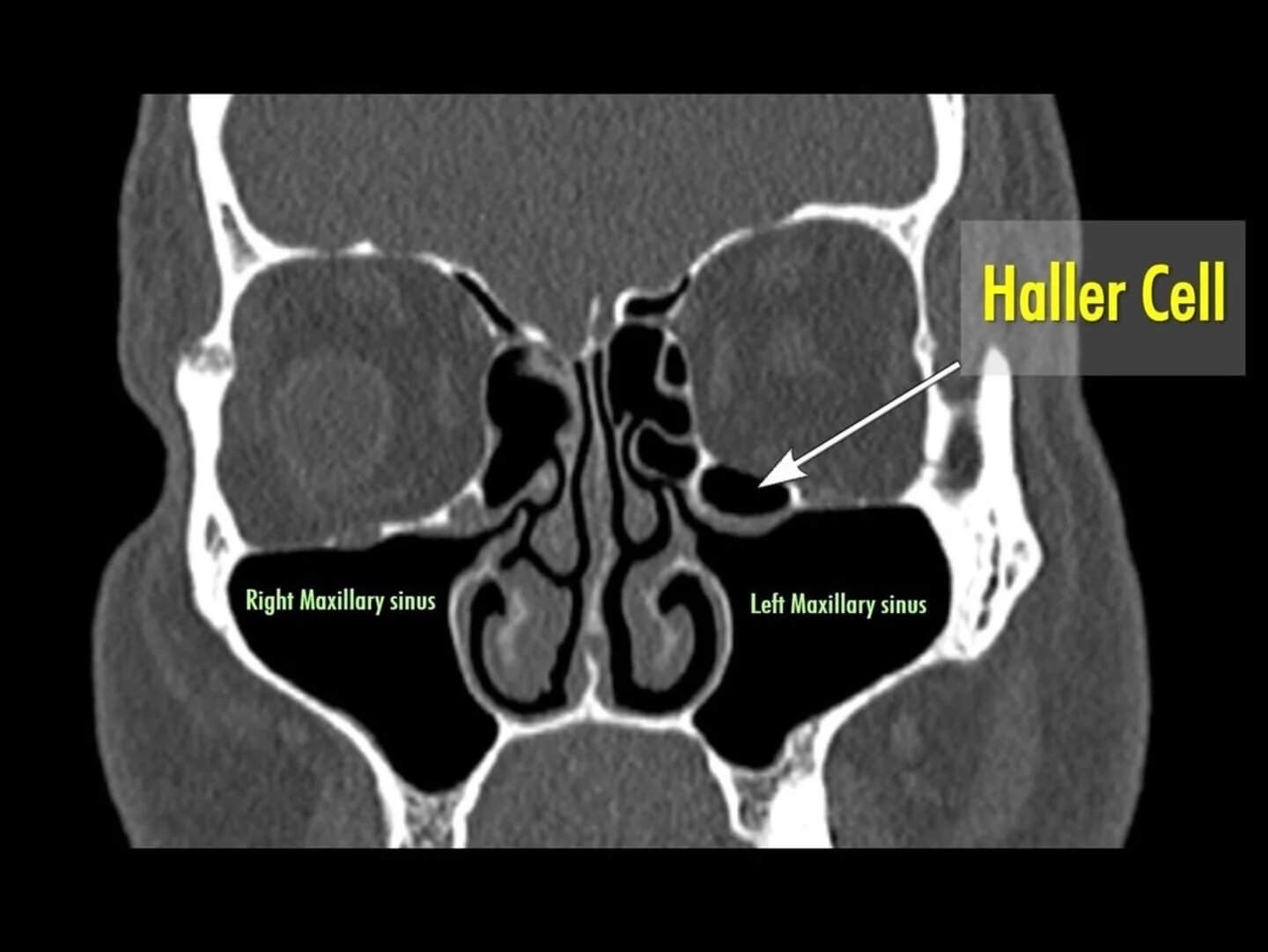 Radiology Vibes | Online Learning Platform For Radiologists.