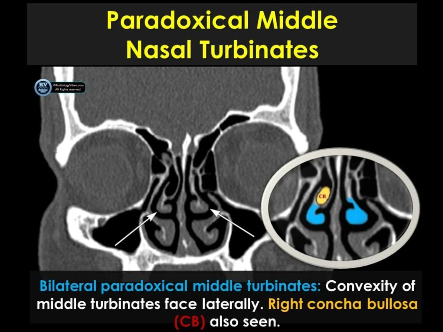 Radiology Vibes | Online Learning Platform For Radiologists.