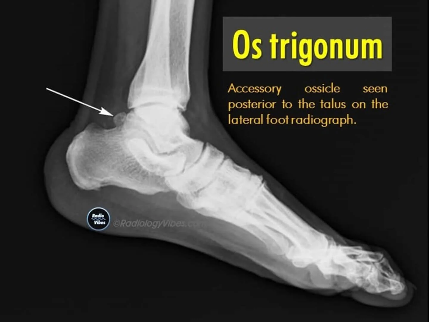 Radiology Vibes | Online Learning Platform For Radiologists.