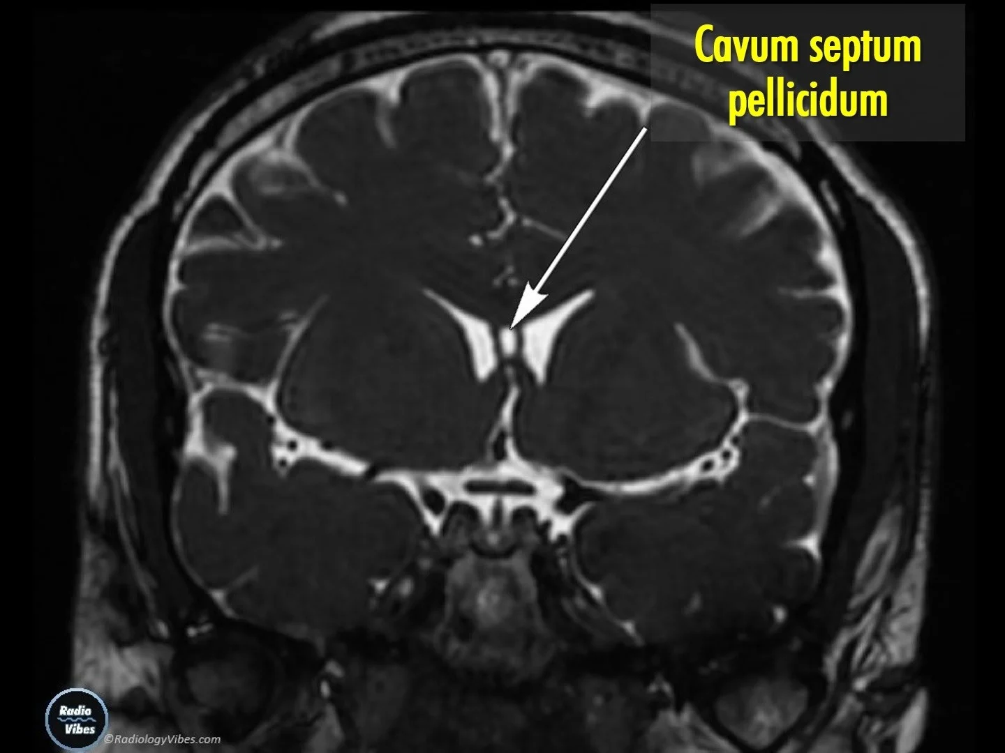 Radiology Vibes | Online Learning Platform For Radiologists.