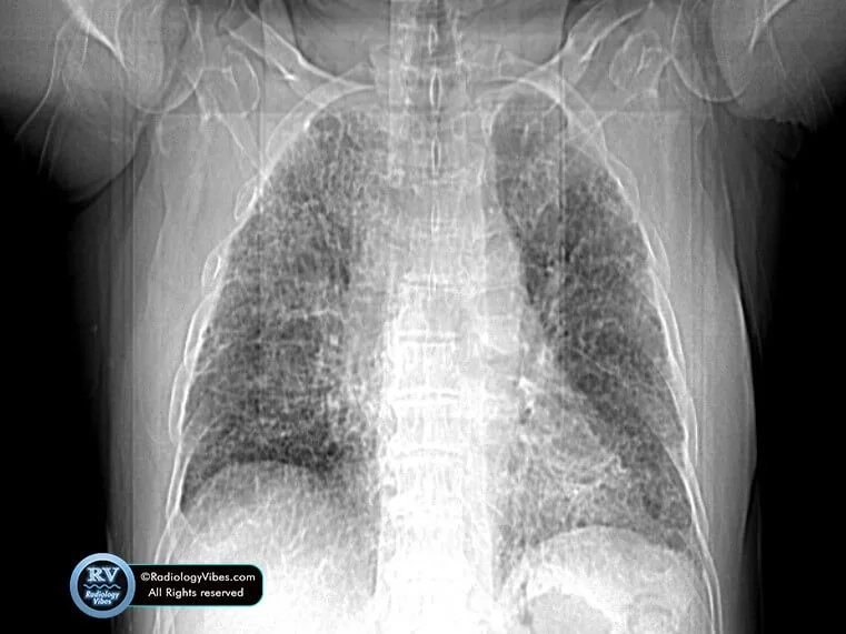 Radiology Vibes | Online Learning Platform For Radiologists.