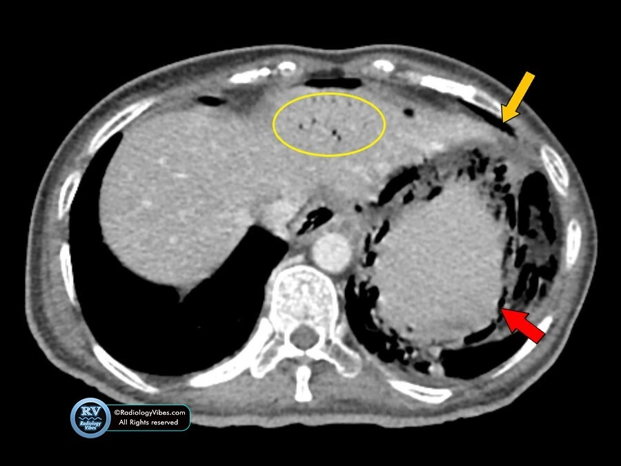 Radiology Vibes | Online Learning Platform For Radiologists.