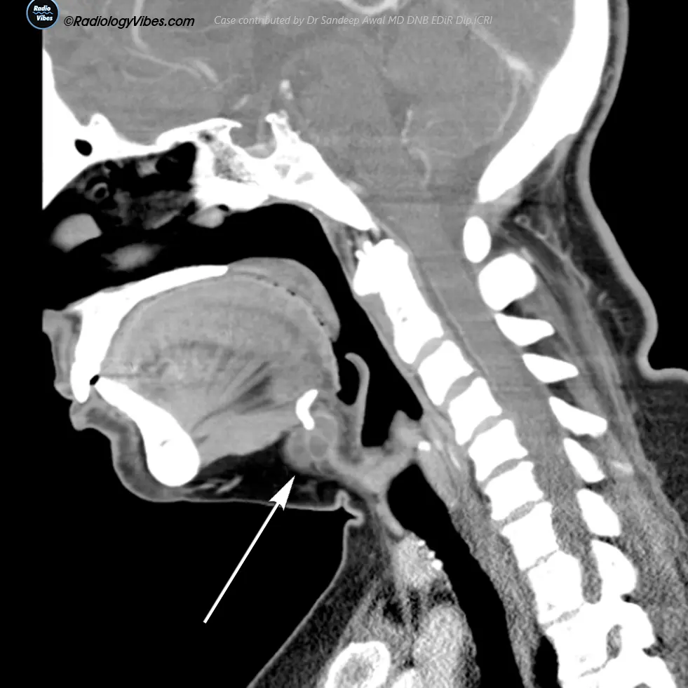 Radiology Vibes | Online Learning Platform For Radiologists.