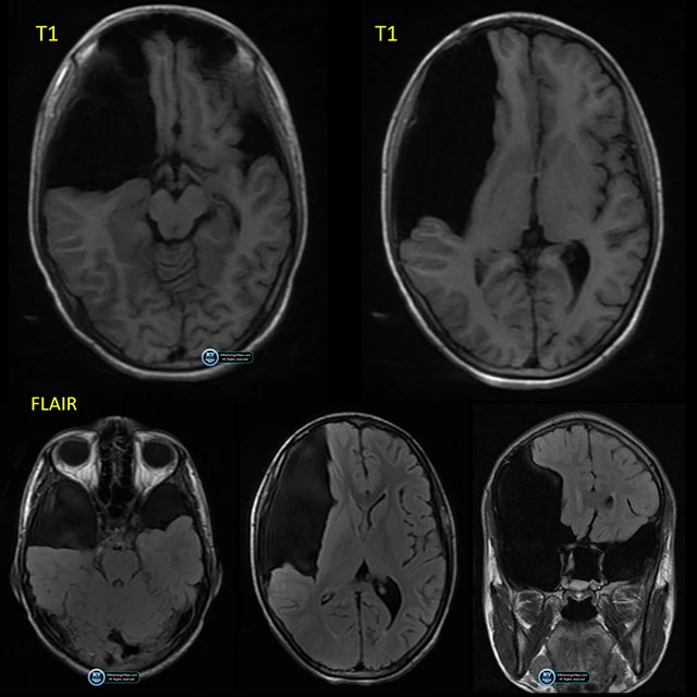 Radiology Vibes | Online Learning Platform For Radiologists.