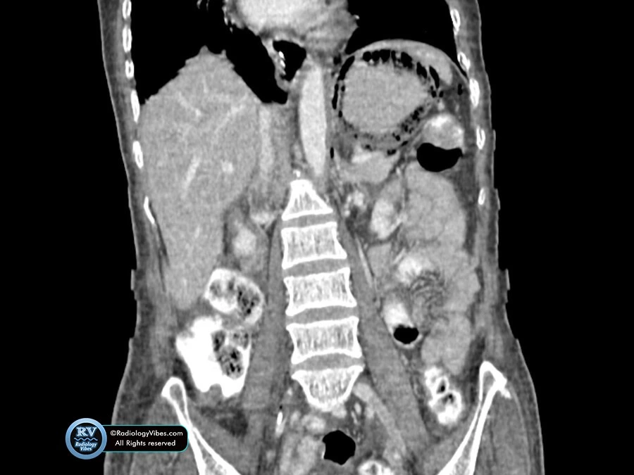 Radiology Vibes | Online Learning Platform For Radiologists.