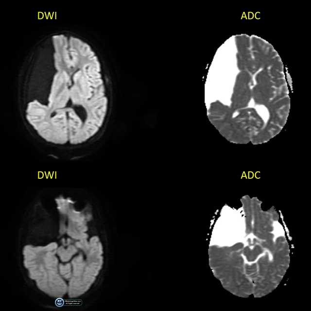 Radiology Vibes | Online Learning Platform For Radiologists.