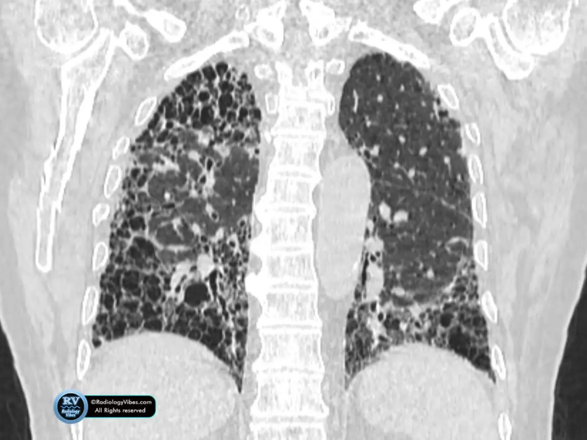 Radiology Vibes | Online Learning Platform For Radiologists.