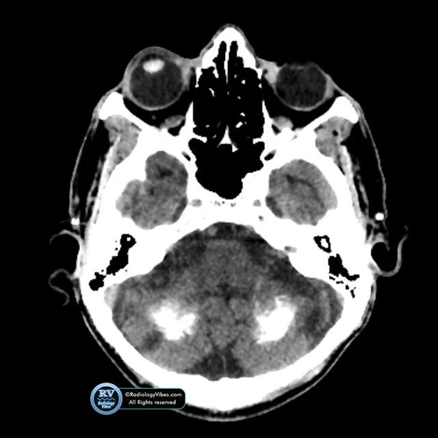 Radiology Vibes | Online Learning Platform For Radiologists.