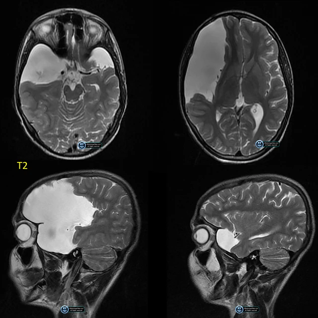 Radiology Vibes | Online Learning Platform For Radiologists.