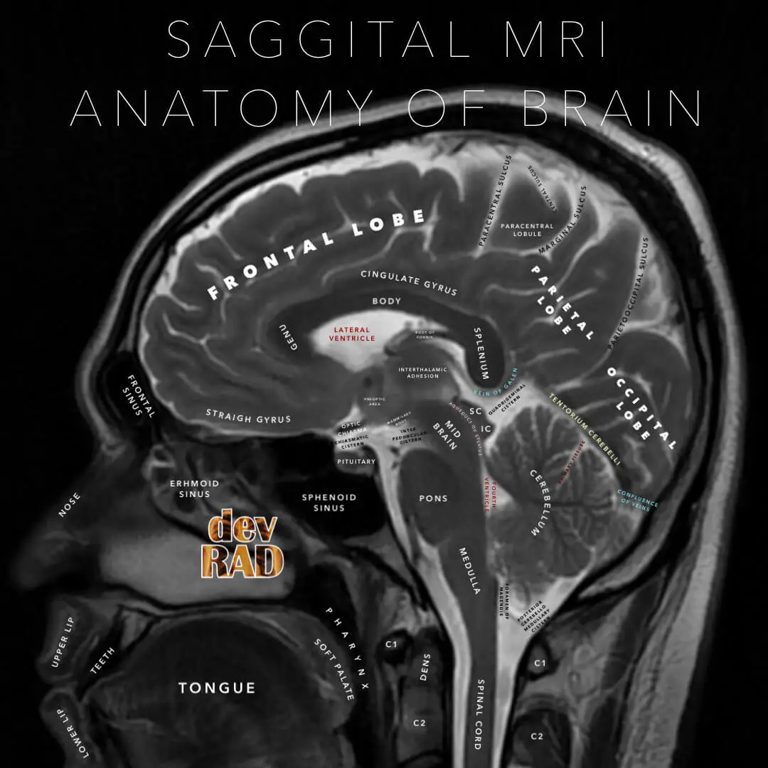 Radiology Vibes | Online Learning Platform For Radiologists.