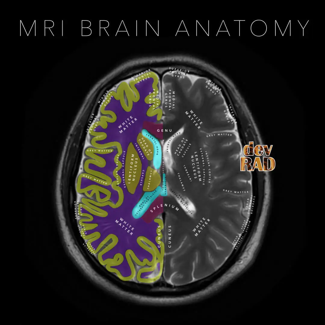 Radiology Vibes | Online Learning Platform For Radiologists.