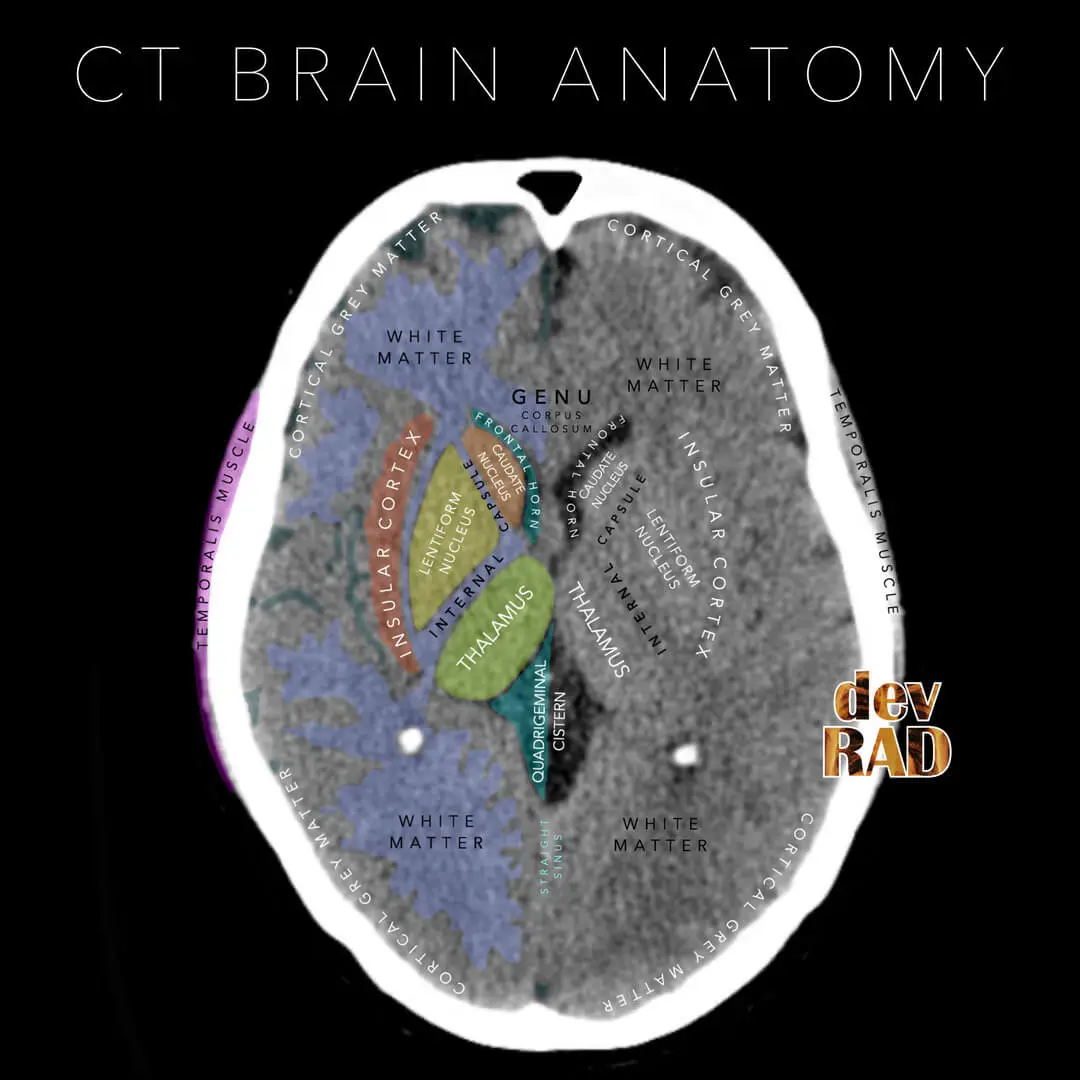 Radiology Vibes | Online Learning Platform For Radiologists.